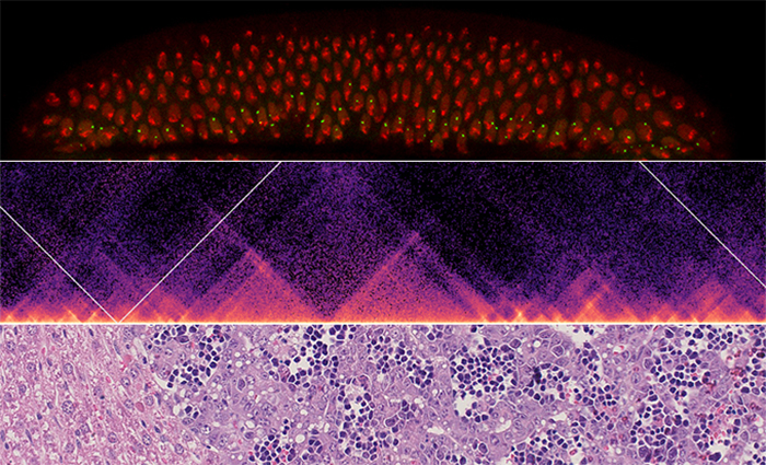 IGMM – Institut de Génétique Moléculaire de Montpellier